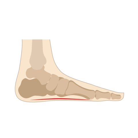 Last van uw voet? - Podoloog Dries De Roover